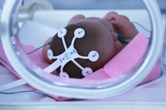 Flexible monitoring devices for infants - Multi-Color Corporation
